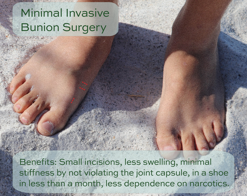 Faster & Fuller Recovery - Align Foot & Ankle